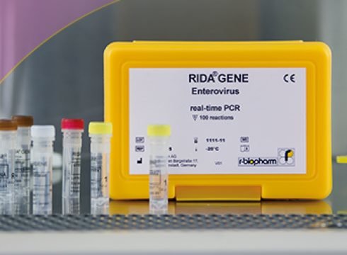 Gastrointestinal infections: Modern solutions for infection diagnostics