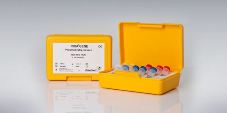 Mycology: Test kits for the diagnostics of mycological infections