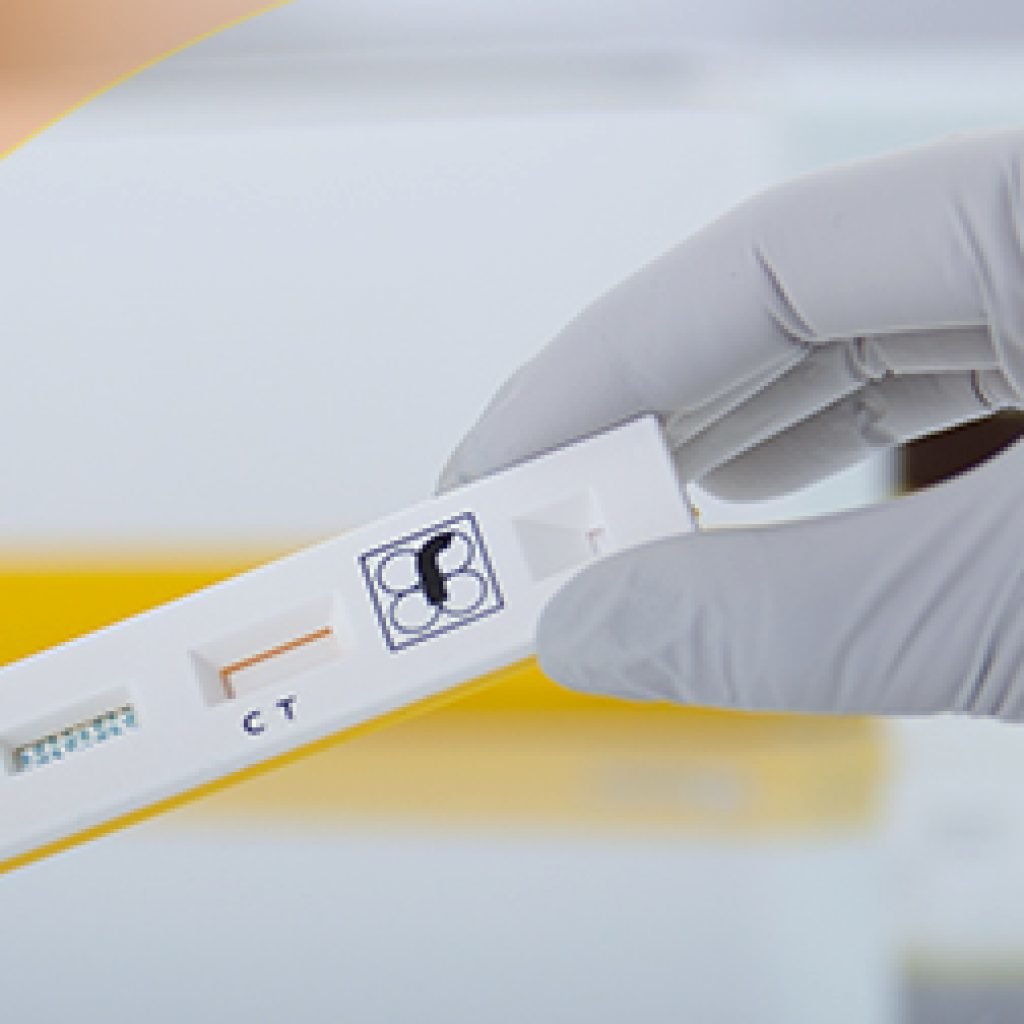 Validazione del kit RIDA®QUICK ADM Monitoring - Clinical Diagnostics