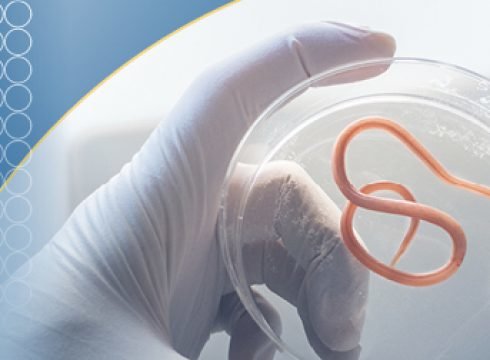 Parasitology: Test kits for the diagnostics of parasitic infections
