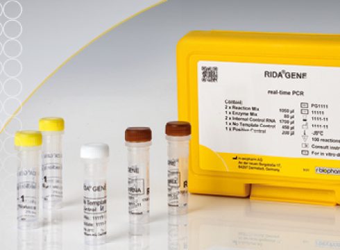 Klinische diagnostiek: Efficiënte diagnostische oplossingen van R-Biopharm