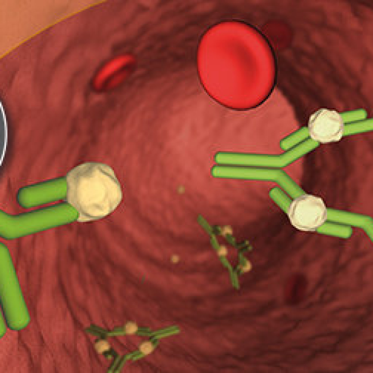 Drug Monitoring of Infliximab (Remicade®)