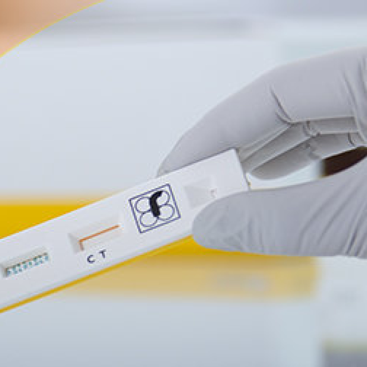 Therapeutic Drug Monitoring: Greater Efficiency through Quick Tests