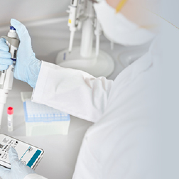 R-Biopharm & Bosch partner to develop molecular diagnostics for ...