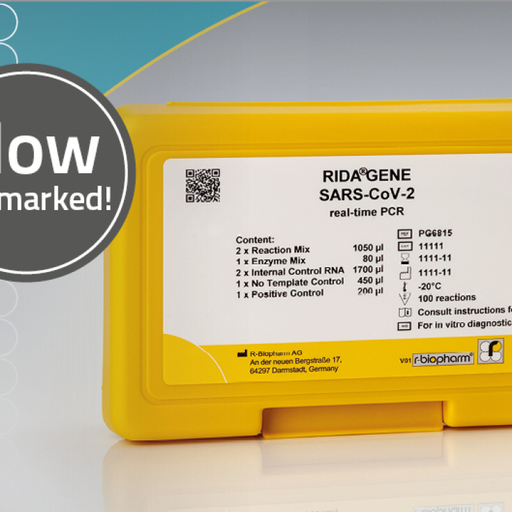 Coronavirus test kit receives CE label - Clinical Diagnostics