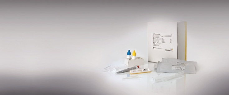 New rapid test format of RIDA®QUICK Norovirus available (en) - Clinical ...